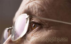 Bị quáng gà là gì? Biểu hiện, nguyên nhân, biện pháp điều trị